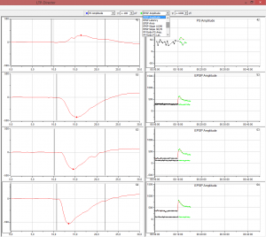 LTP-SignalDetectionAnalysis.png | www.multichannelsystems.com